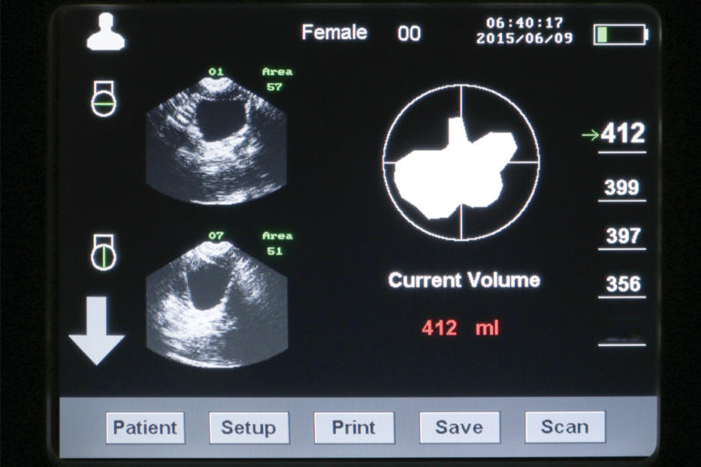 Choosing the Right Bladder Scanner: Expert Advice | Direct Supply